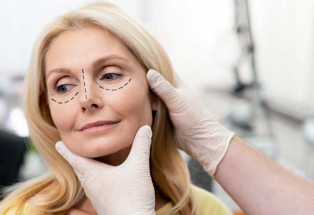 HLH Facelift - BME Clinics